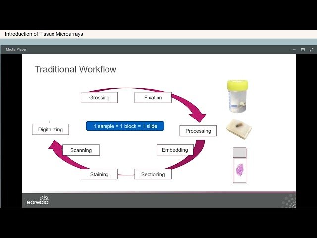 Free Video: Introduction to Tissue Microarrays - Applications and Creation Methods from Labroots ...