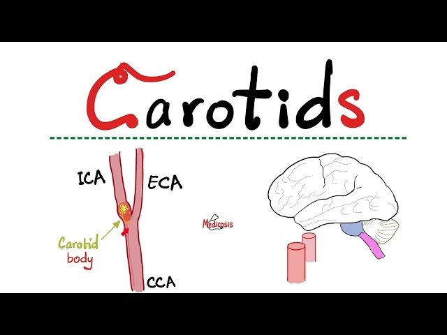 Free Video: Carotid Arteries - Internal Carotid Artery (ICA), External ...