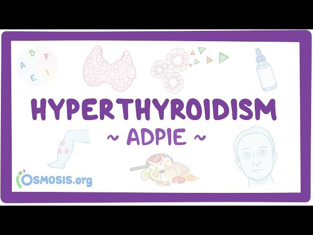 Free Video: Hyperthyroidism - Nursing Process (ADPIE) from Osmosis ...