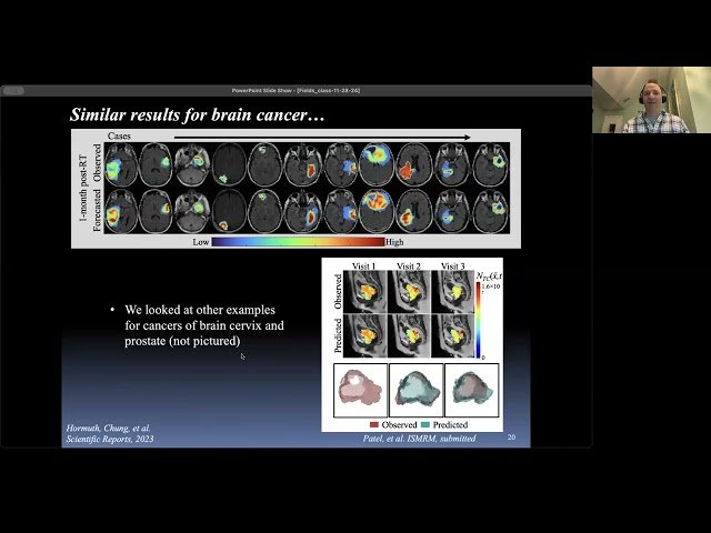 Free Video: Optimizing Interventional Strategies to Optimize Treatment ...