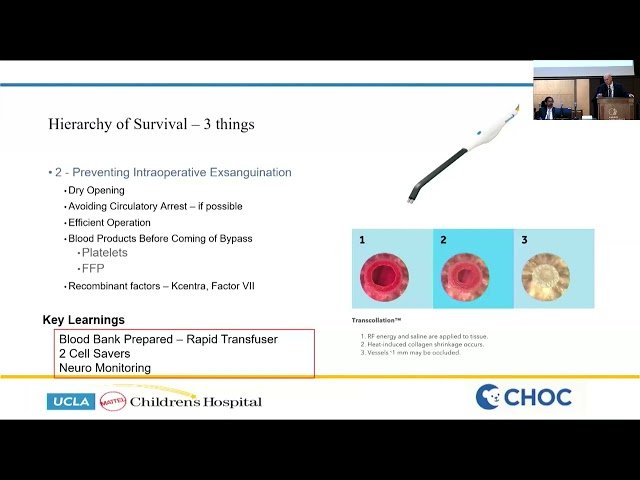 Free Video: Orthotopic Heart Transplant vs Combined Heart-Lung ...