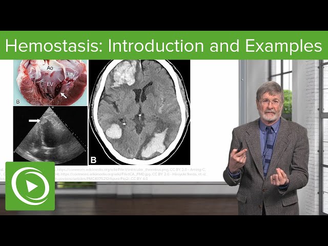 Free Video: Cellular Pathology - USMLE Prep Videos from Lecturio ...