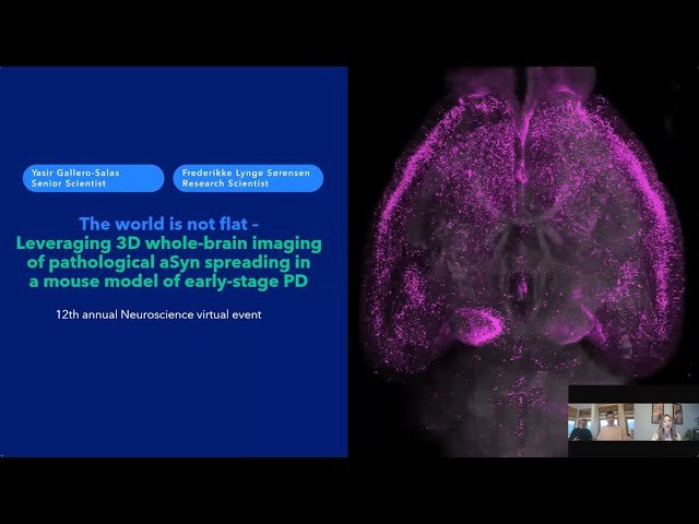 Free Video: The World is Not Flat - Leveraging 3D Whole-Brain Imaging of Pathological α ...