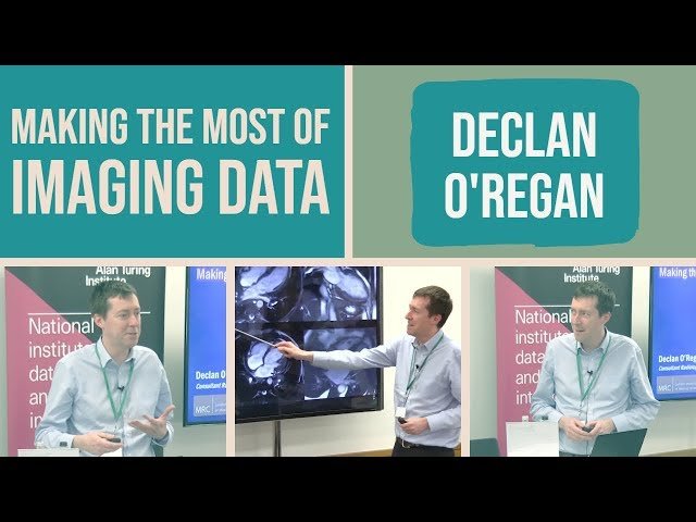 Free Video: Making the Most of Imaging Data - Declan O'Regan, Imperial ...