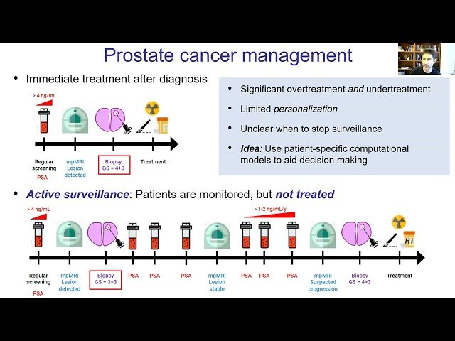 Free Video: Prostate: Small Organ, Big Problems - Informing Clinical Decisions with ...