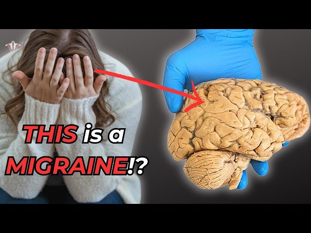 Free Video: Why Migraines Are More Than Just a Headache from Institute ...