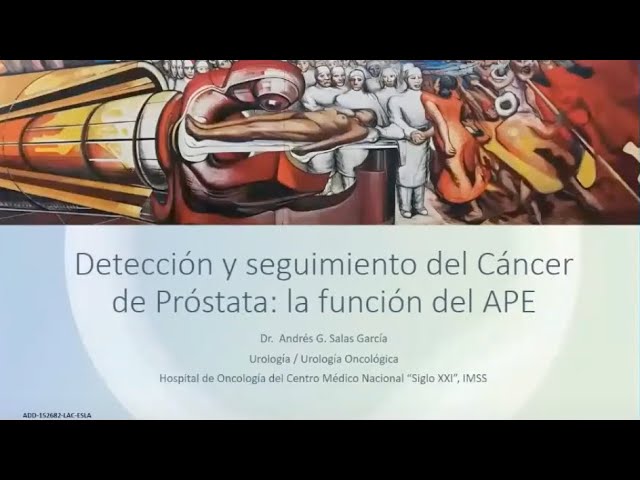 Free Video: Prostate Cancer Screening and Monitoring: The Role of PSA ...
