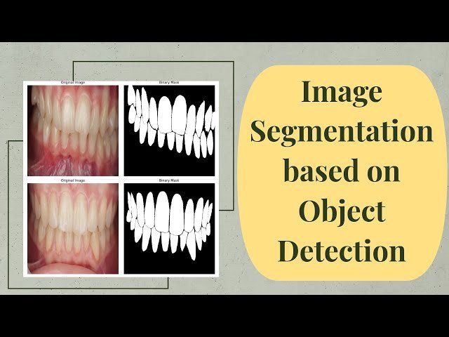 Free Video: How I Got Segmentation Masks from Object Detection - Teeth Segmentation Tutorial ...