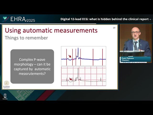 Free Video: The Importance of ECG and Intracardiac Signal Quality from ...