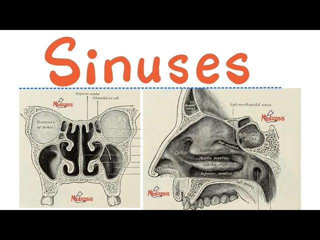 Free Video: Anatomy of Sinuses - Paranasal Sinuses - Anatomy of the ...
