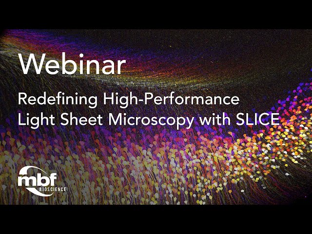 Free Video: Redefining High-Performance Light Sheet Microscopy with SLICE from MBF Bioscience ...