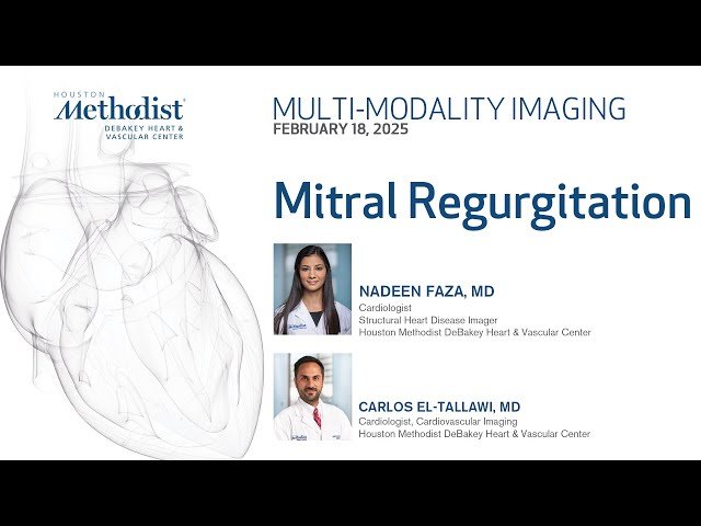 Free Video: Mitral Regurgitation - Multimodality Imaging from Houston ...