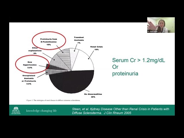 Free Video: Beyond the Crisis: Kidney Health and Scleroderma from ...