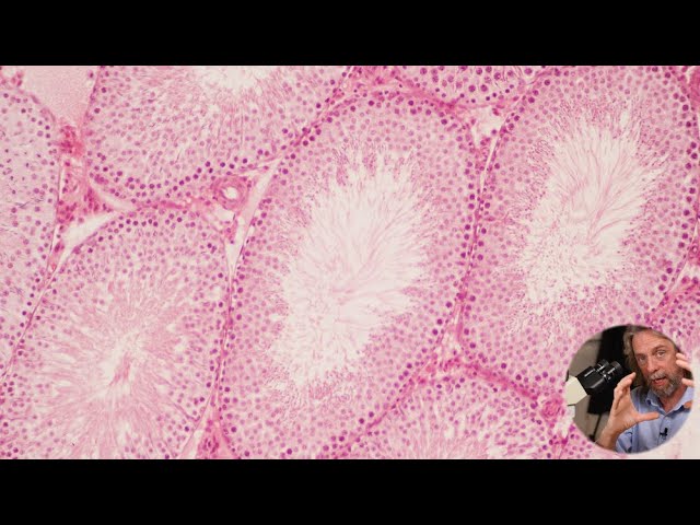 Free Video: Microscopic Anatomy of the Testis - From Seminiferous ...